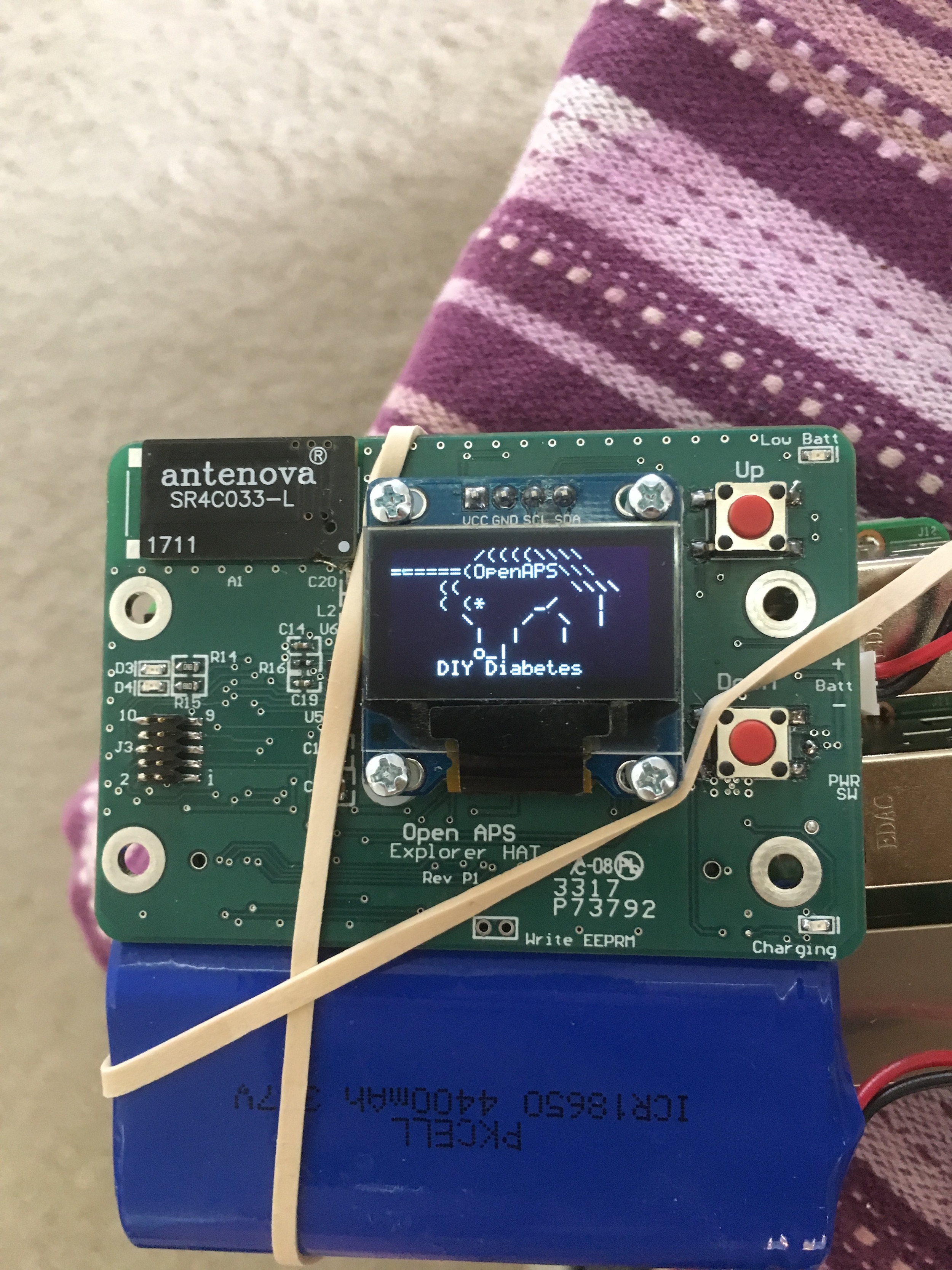 Next generation #OpenAPS hardware work in progress – Pi HATs | DIYPS.org
